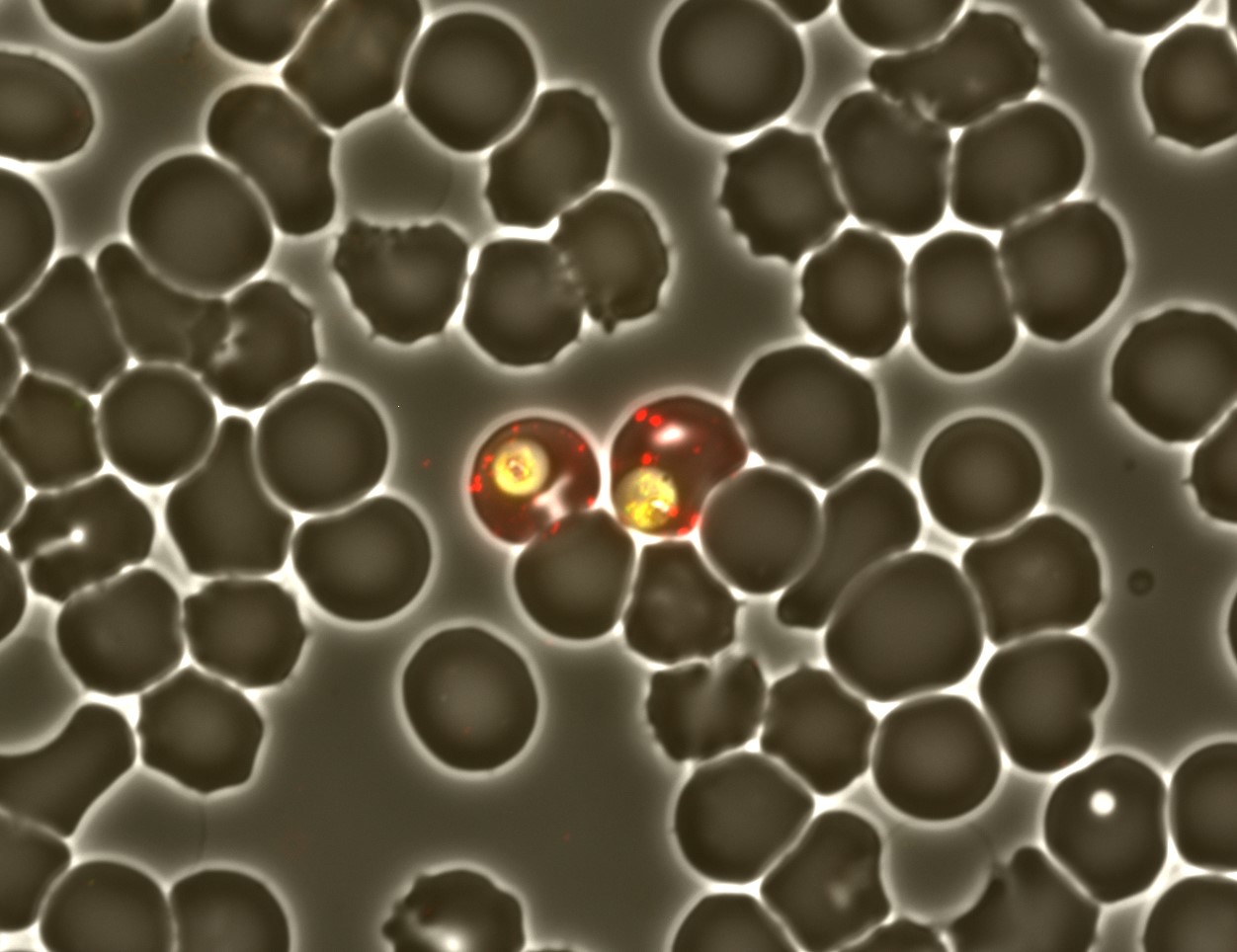 Microbiology and Infectious Disease – ISMB